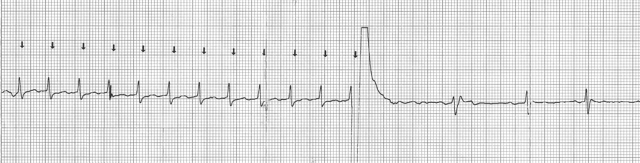 Defibrillation / Kardioversion 2