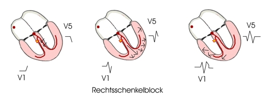 Schenkelblockbilder 2